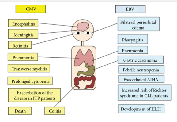 Epstein-Barr Virus (EBV) Antibody Profile | Second Opinion Physician