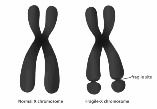 Fragile X Syndrome Testing | Genetics & Symptoms